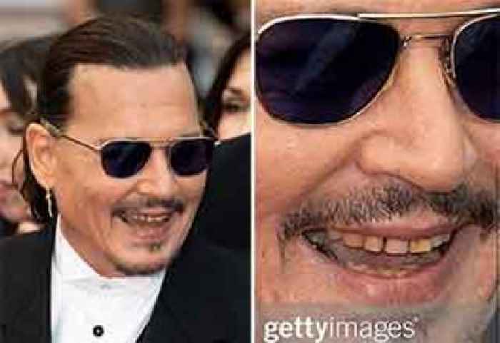 Johnny Depp's Teeth Are as Rotten as He Is - One News Page
