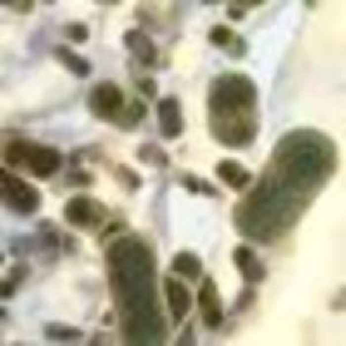 Artificial intelligence helping scientists in fight - One News Page Artificial intelligence helping scientists in fight - One News Page