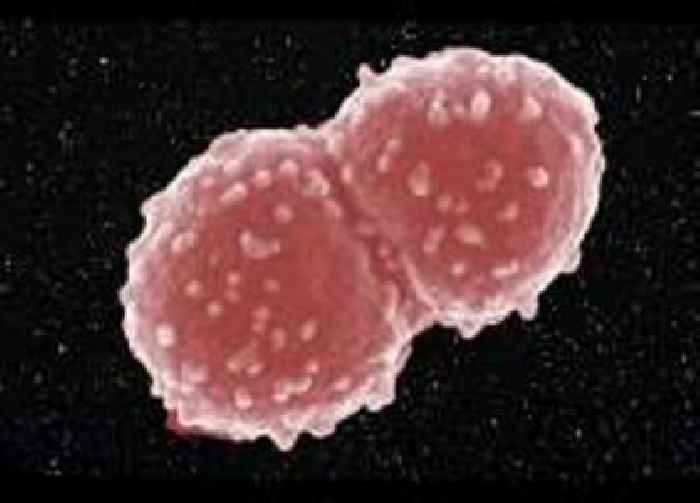 How Deinococcus Radiodurans thrives in extreme - One News Page