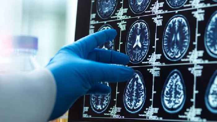 Menopause 'triggers loss of brain matter which could - One News Page