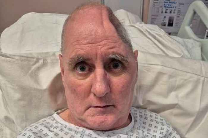 Essex cyclist loses quarter of skull after hitting - One News Page